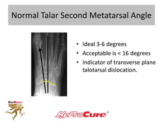 Understanding Talotarsal Displacement | PPT