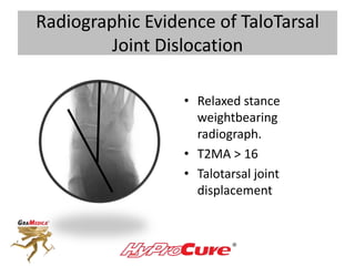 Understanding Talotarsal Displacement | PPT