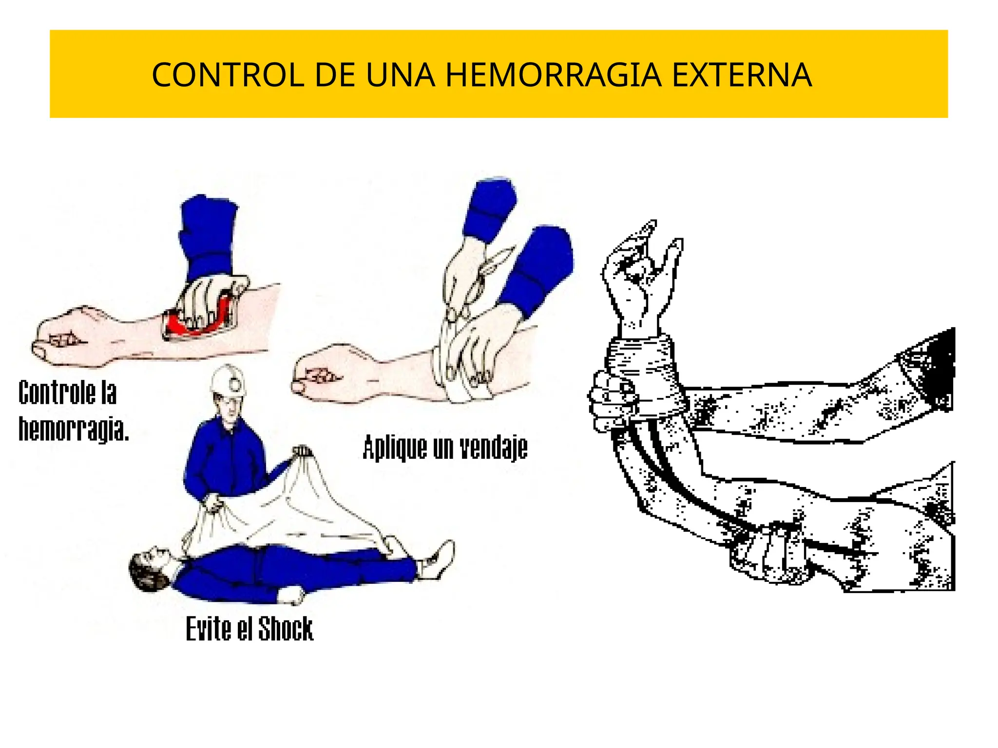 PRIMEROS AUXILIOS, capacitacion de primeros respondientes. | PPTX