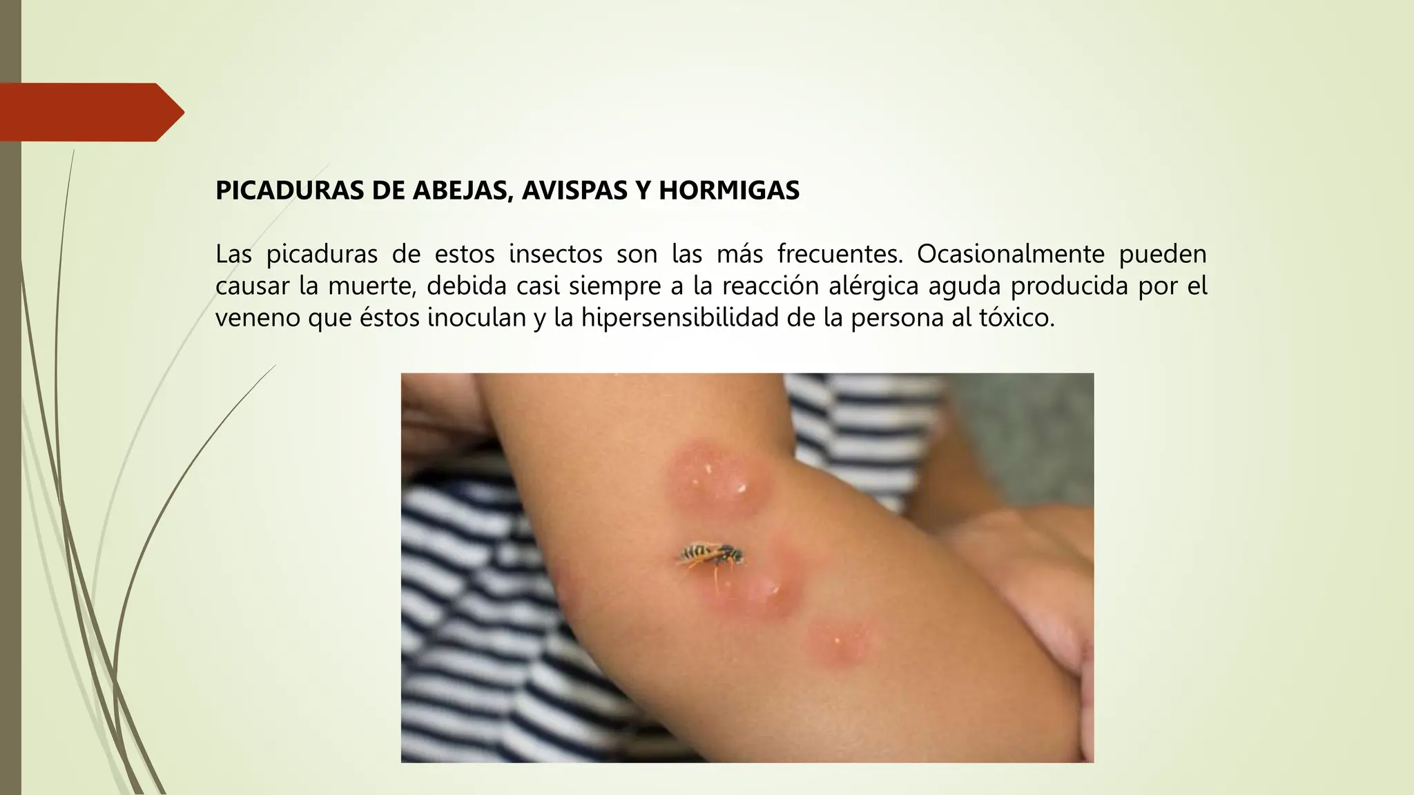 PRIMEROS AUXILIOS EN MORDEDURAS Y PICADURAS.pptx