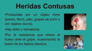 primeros auxilios basicos en el area escolar | PPTX
