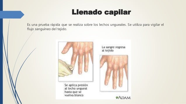 Primeros auxilios fv