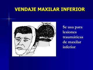Primeros Auxilios III FRACTURAS.ppt
