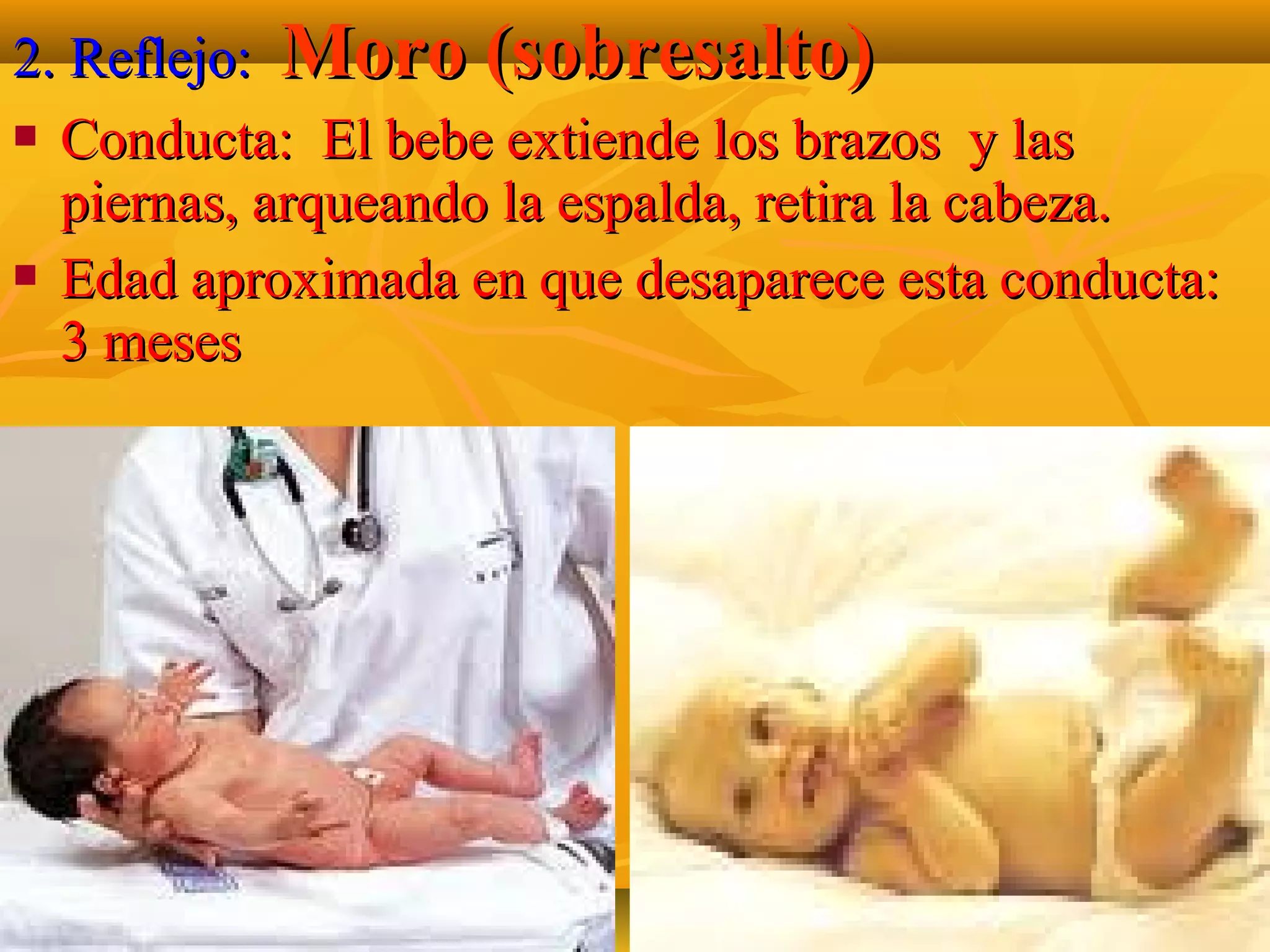 Primeros reflejos del bebe | PPT