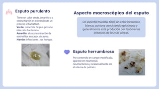 Semiologia y exploracion fisica neumologia | PDF