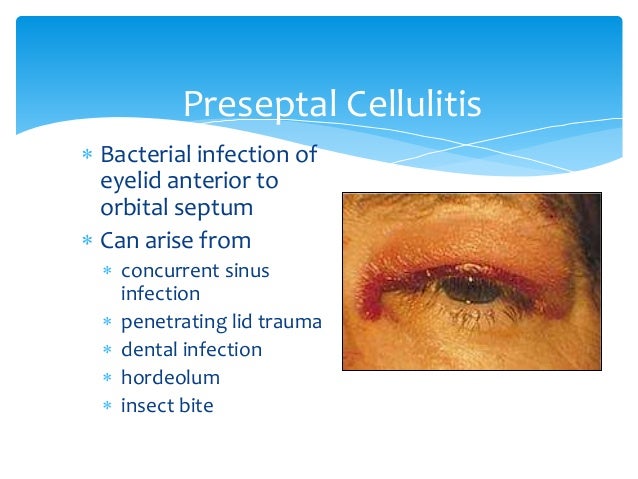 Primary eye care Doctor of Optometry