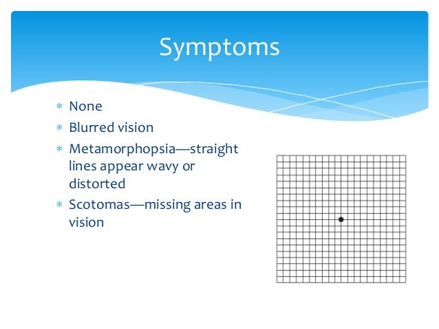 Primary eye care Doctor of Optometry