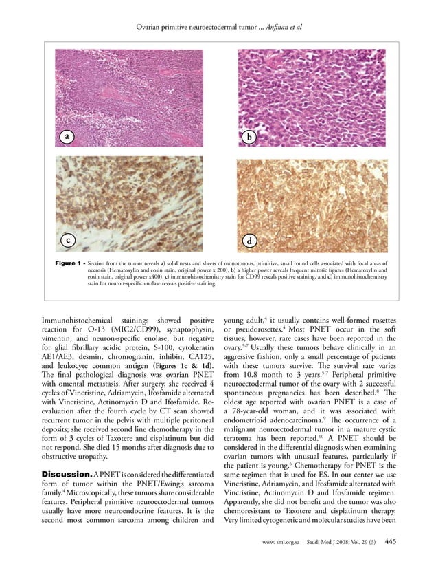 Primitive Neuroectodermal Tumor Of The Ovary Pdf
