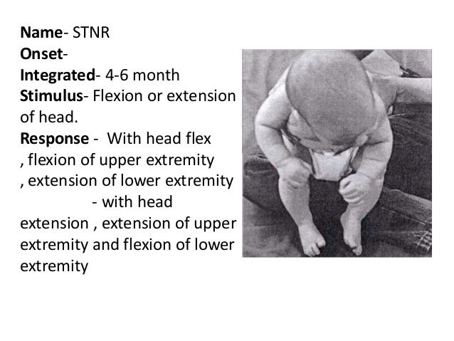 Primitive and tonic reflex