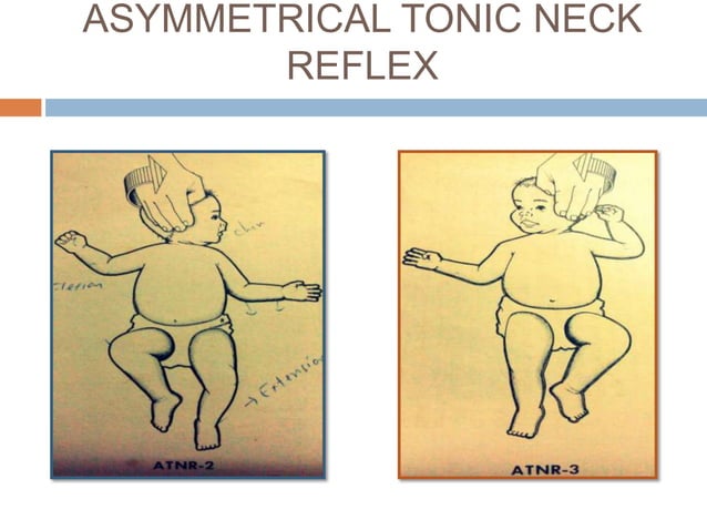 Primitive And Tonic Reflexes | PPTX | Classical Music | Music