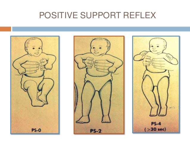 Primitive And Tonic Reflexes