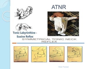 Primitive reflexes | PPTX