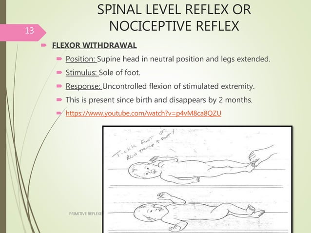 Primitive reflexes | PPTX