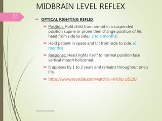 Primitive reflexes | PPTX