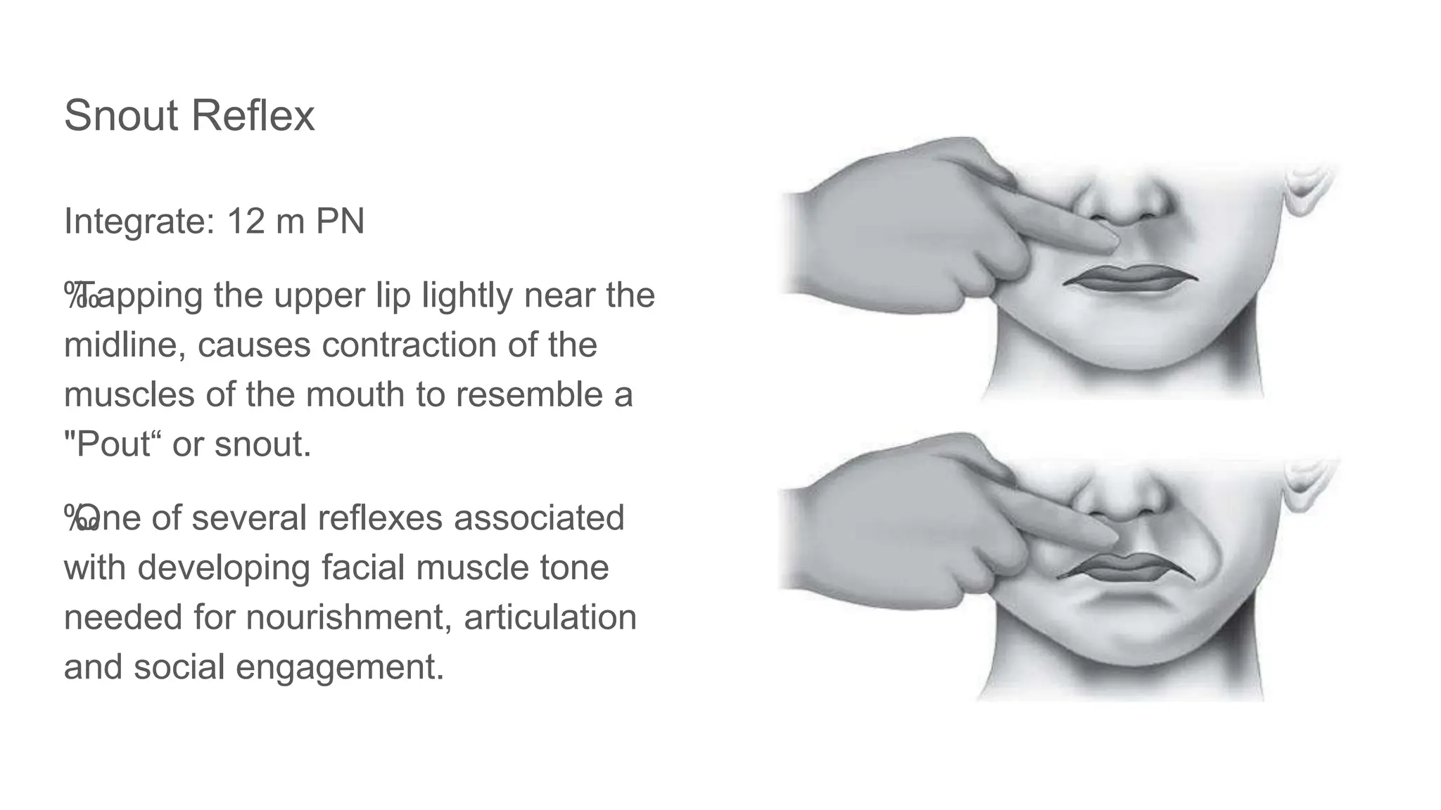 Primitive reflexes and therir pathway . pptxtx | PPTX