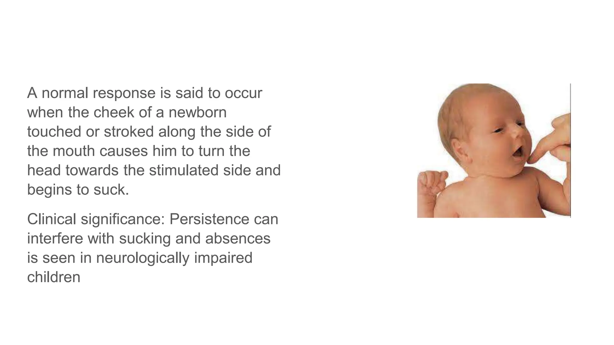 Primitive reflexes and therir pathway . pptxtx | PPTX