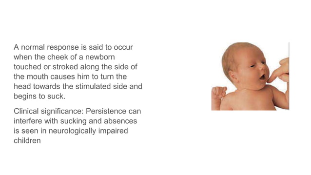 Primitive reflexes and therir pathway . pptxtx | PPTX