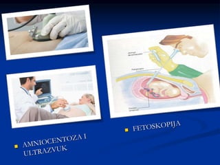 Primjena genetike | PPT