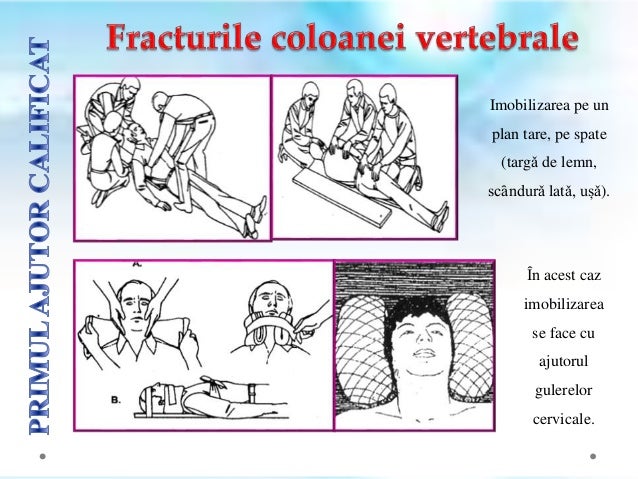 Primul ajutor calificat