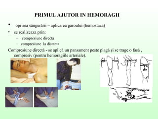 Primul ajutor in caz de accident | PPT