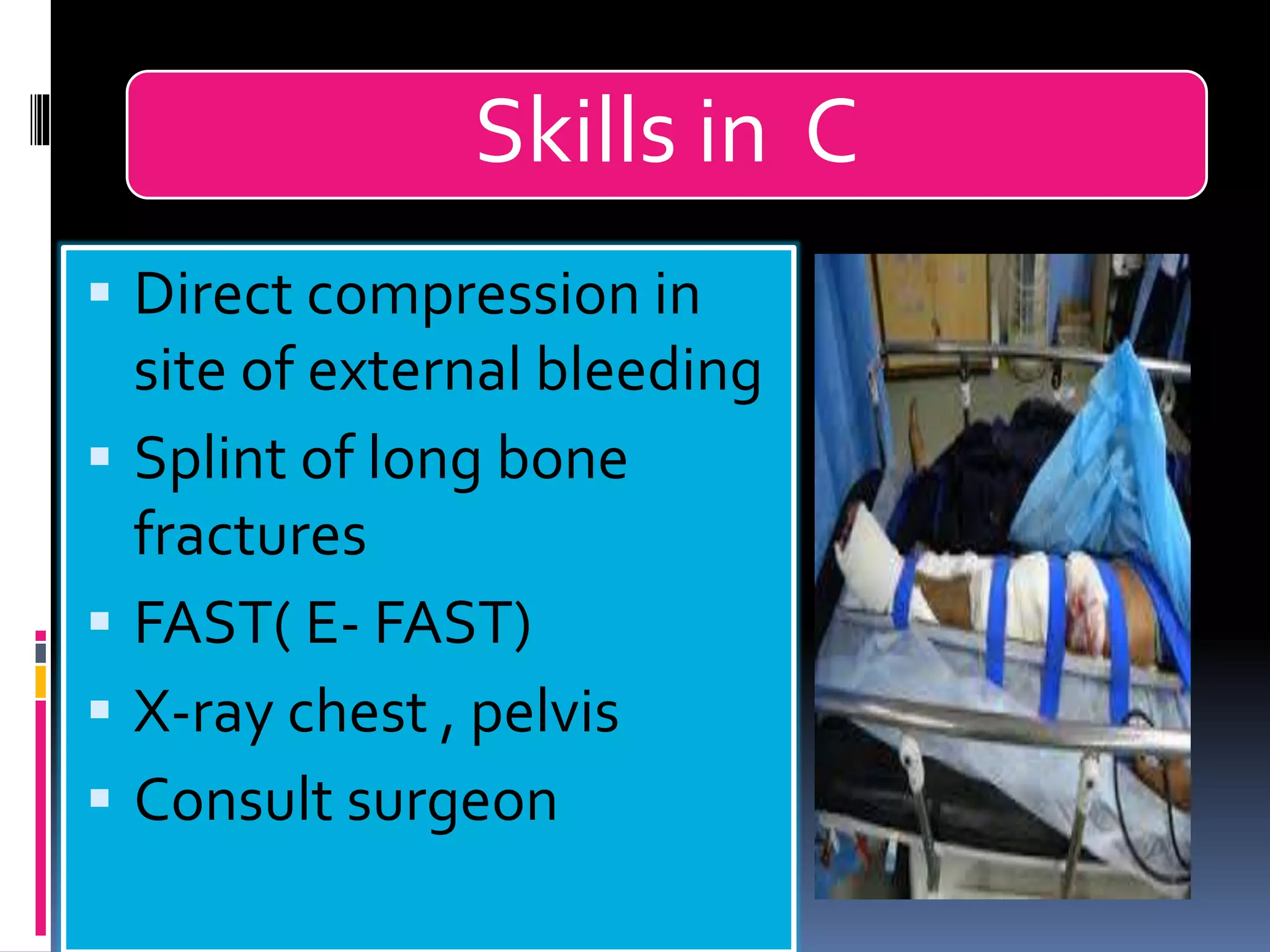 Prinary survey ATLS | PPTX
