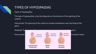 THIS IS A MATERNAL/OBSTETRIC REPORT FOR NURSING | PPTX