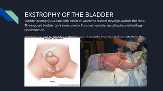 THIS IS A MATERNAL/OBSTETRIC REPORT FOR NURSING | PPTX