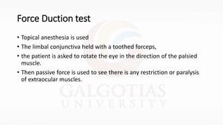 Prince investigation in paralytic strabismus | PPT