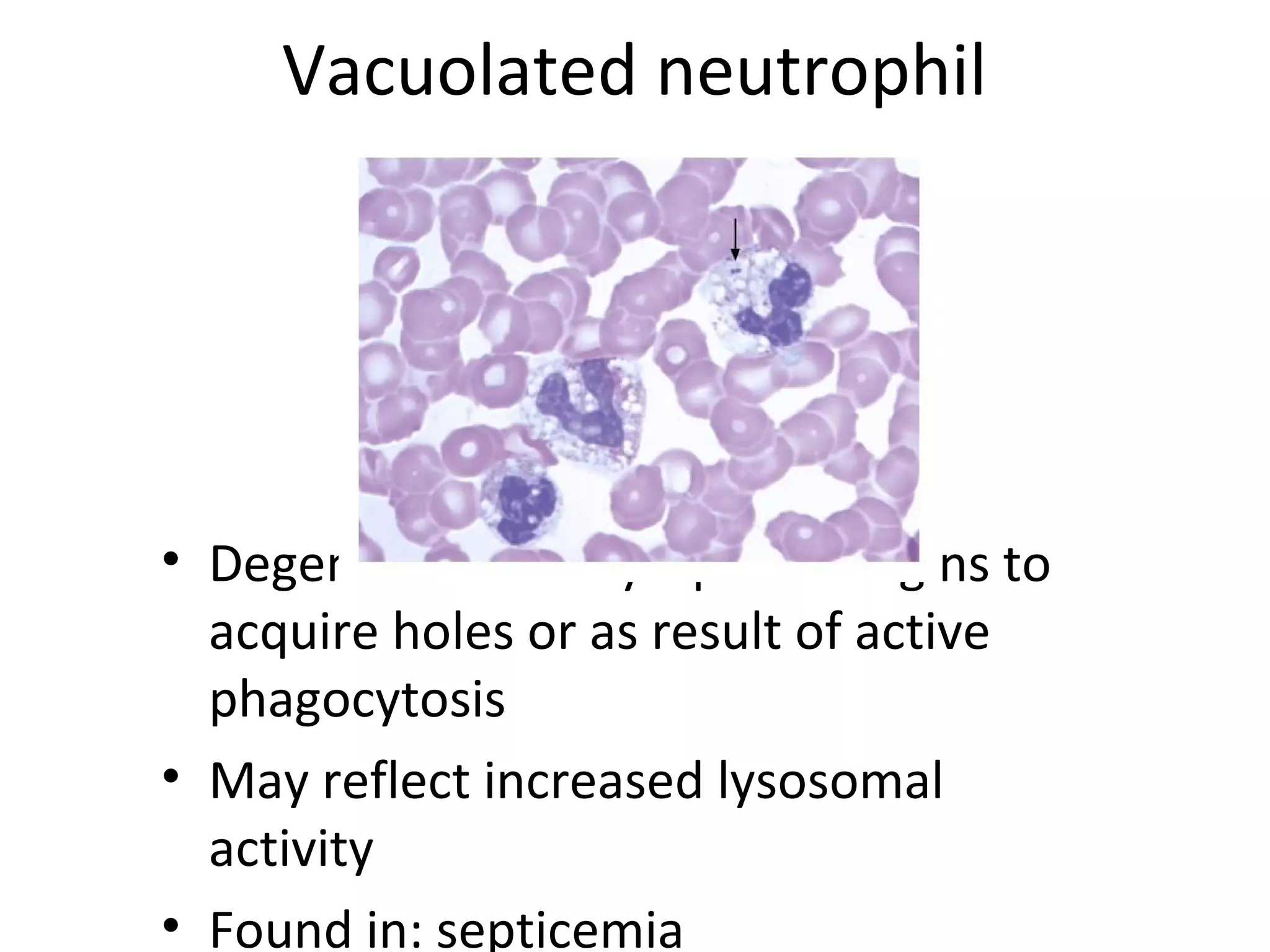 Morphology of white blood cells | PPT