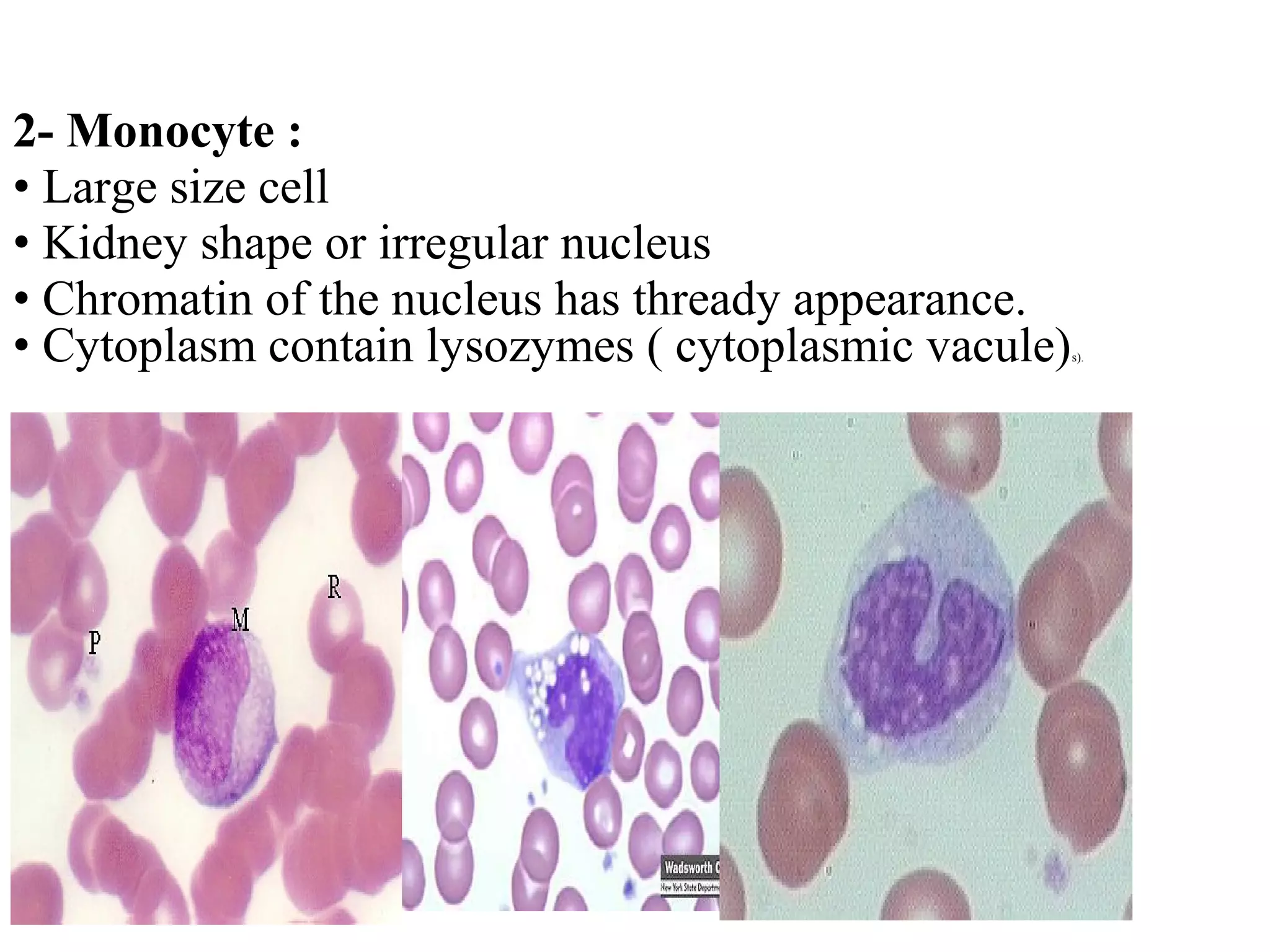 Morphology of white blood cells | PPT