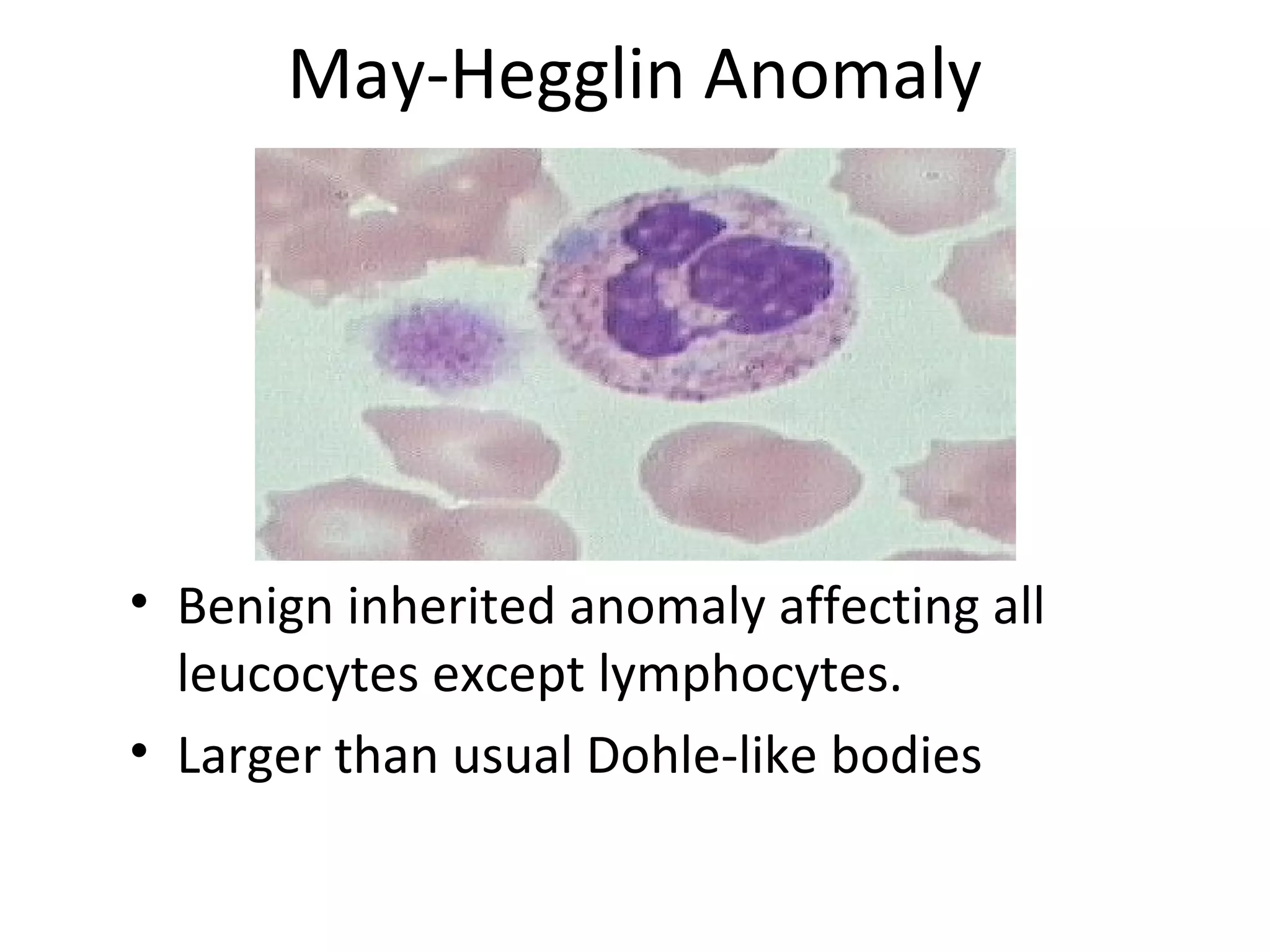 Morphology of white blood cells | PPT