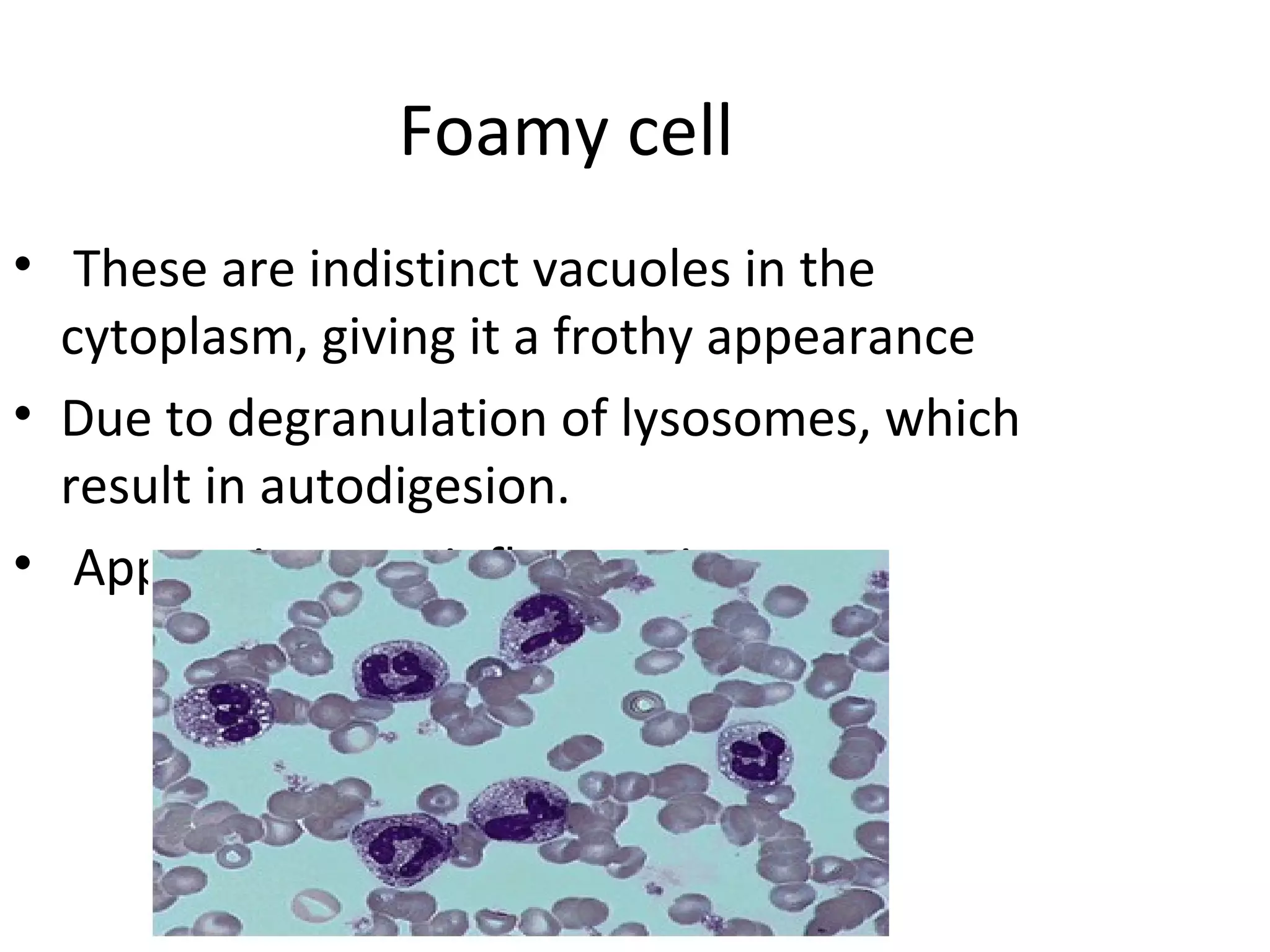 Morphology of white blood cells | PPT