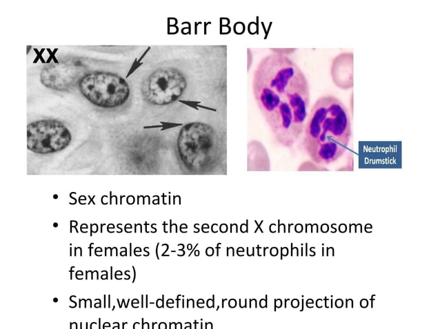 Morphology of white blood cells | PPT