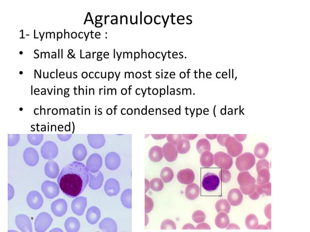 Morphology of white blood cells | PPT