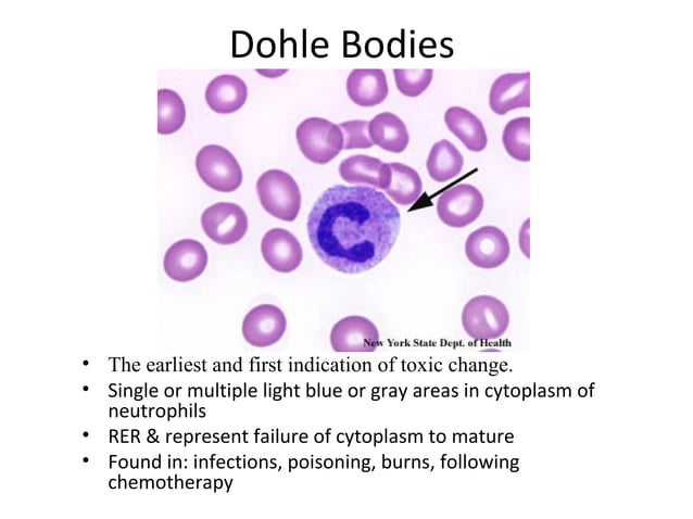 Morphology of white blood cells | PPT
