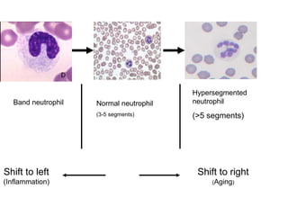 Morphology of white blood cells | PPT