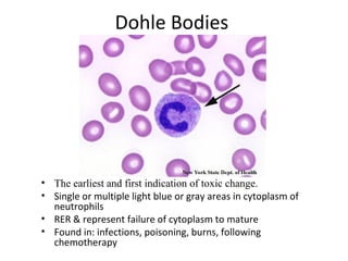 Dohle Bodies