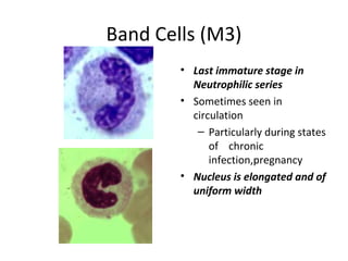 Immature Band Cells