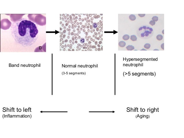 Morphology of white blood cells