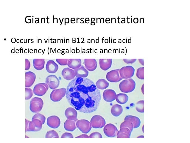 Morphology of white blood cells