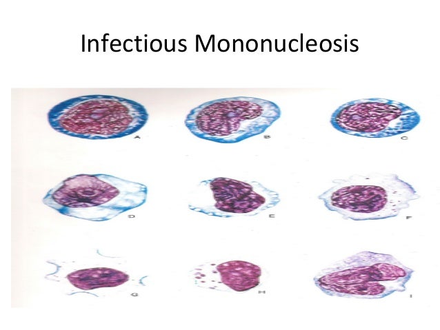 Morphology of white blood cells