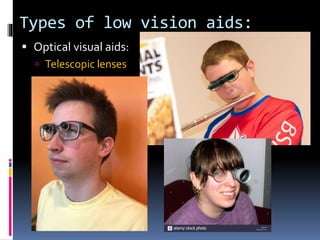 Princibles of low vision aids 2020 | PPT