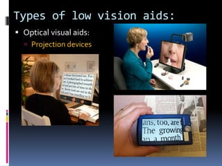 Princibles of low vision aids 2020 | PPT