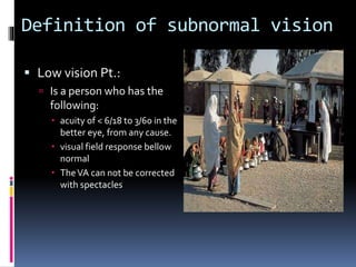 Princibles of low vision aids 2020 | PPT | Free Download
