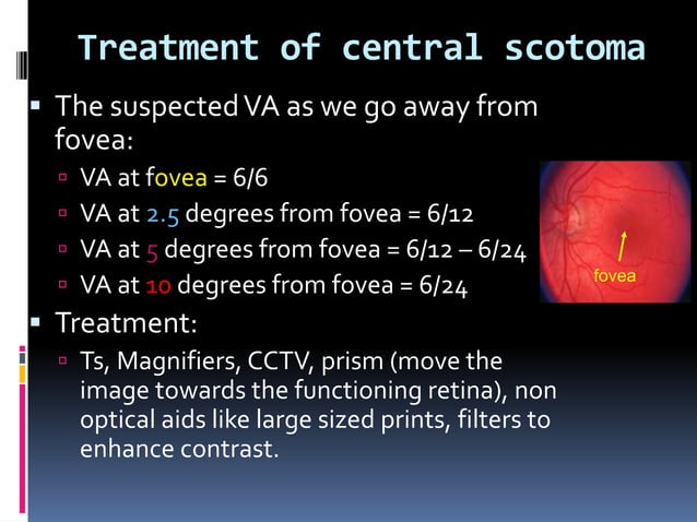 Princibles of low vision aids 2020 | PPT