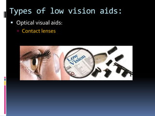 Princibles of low vision aids 2020 | PPT