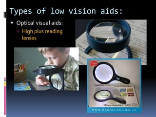 Princibles of low vision aids 2020 | PPT