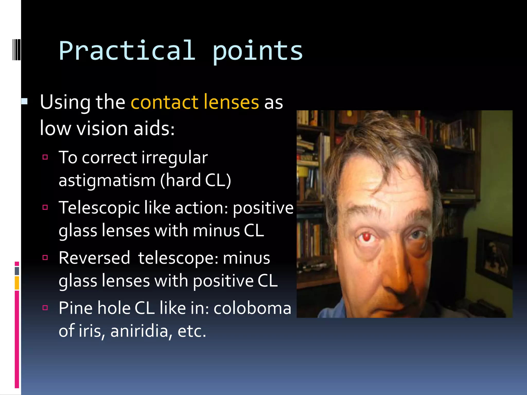 Princibles of low vision aids .pptx