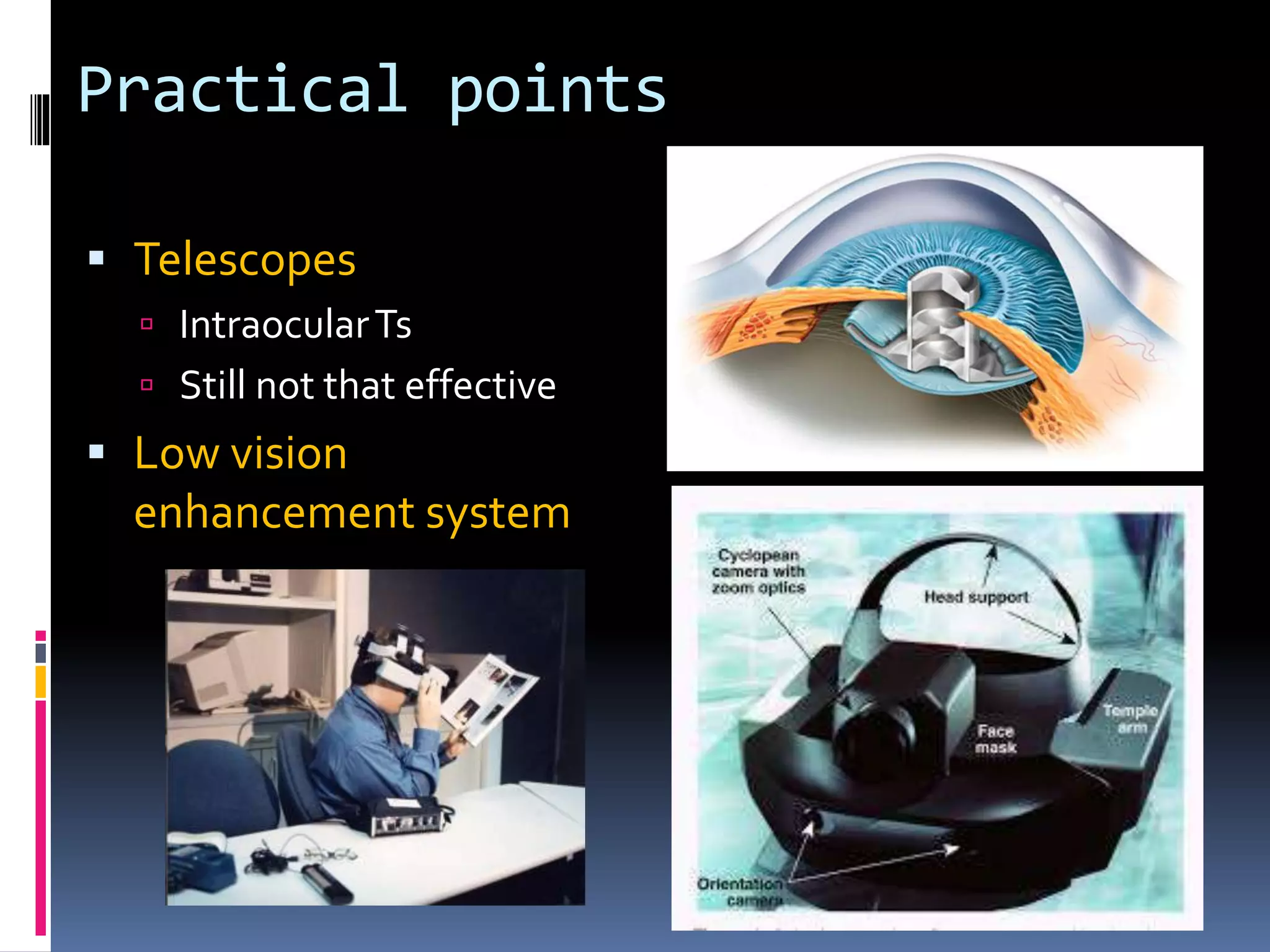 Princibles of low vision aids .pptx