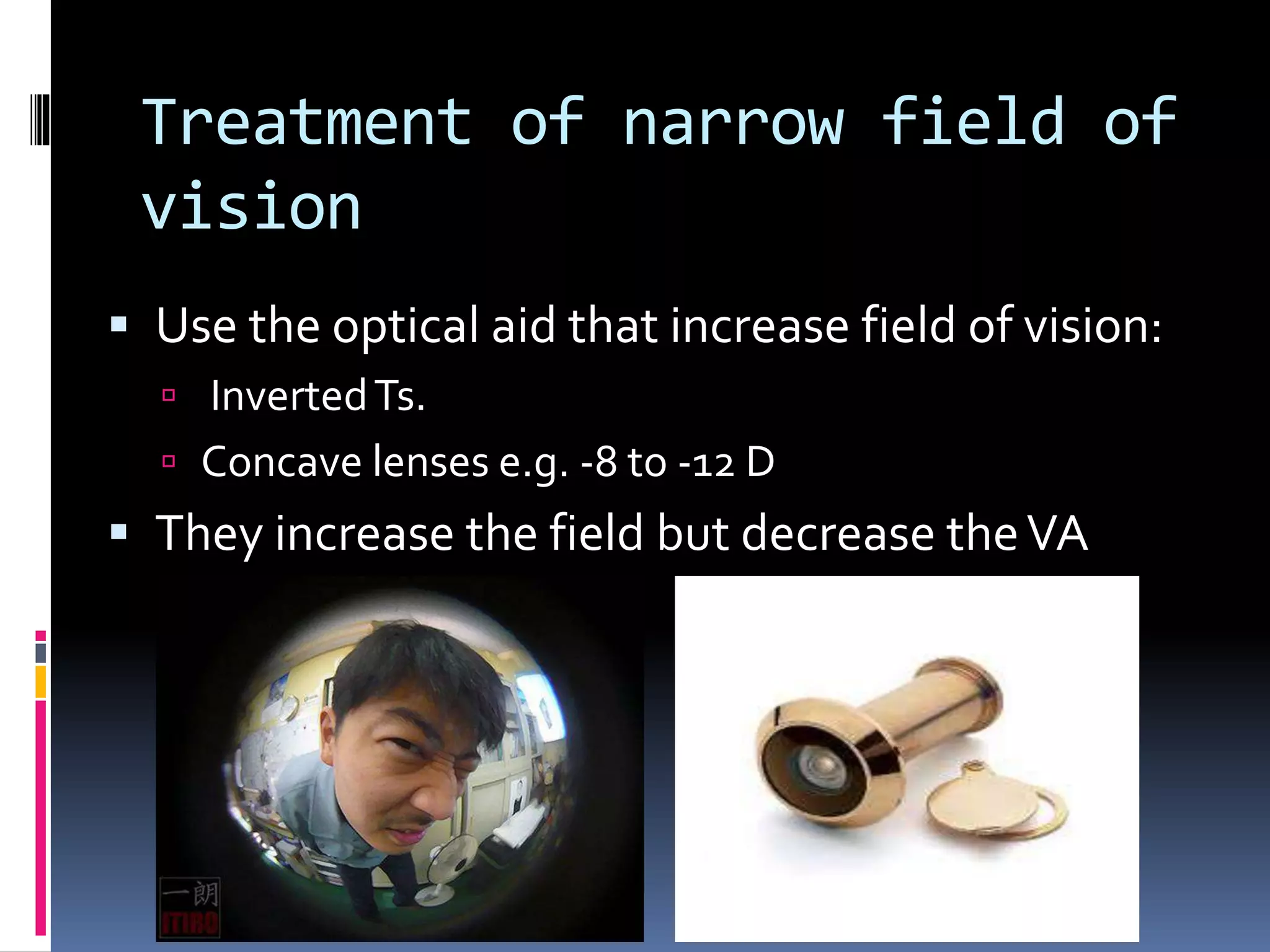 Princibles of low vision aids .pptx